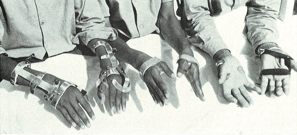 Poisoned cooking oil, Morocco’s most tragic sanitary catastrophe